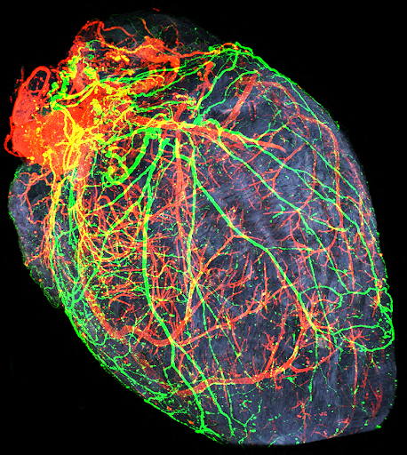 Heart and heart sympathetic nerves (mouse) | Volume Imaging by Csaba Adori